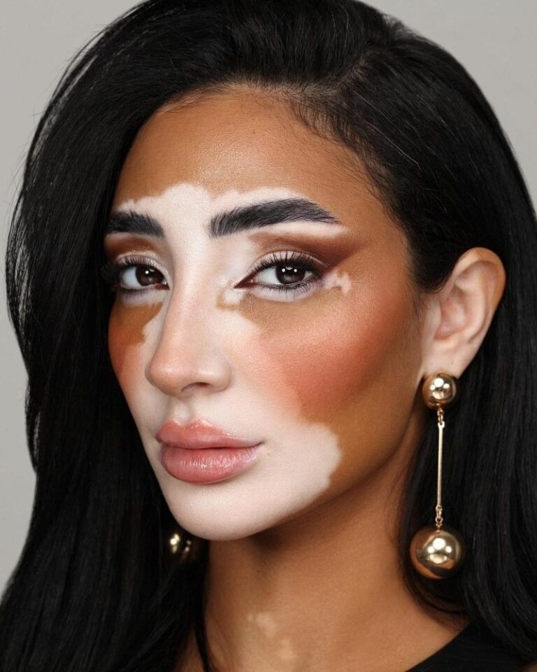 Popular / ¡Miss Egipto, es la primera mujer con vitíligo que concursará ...